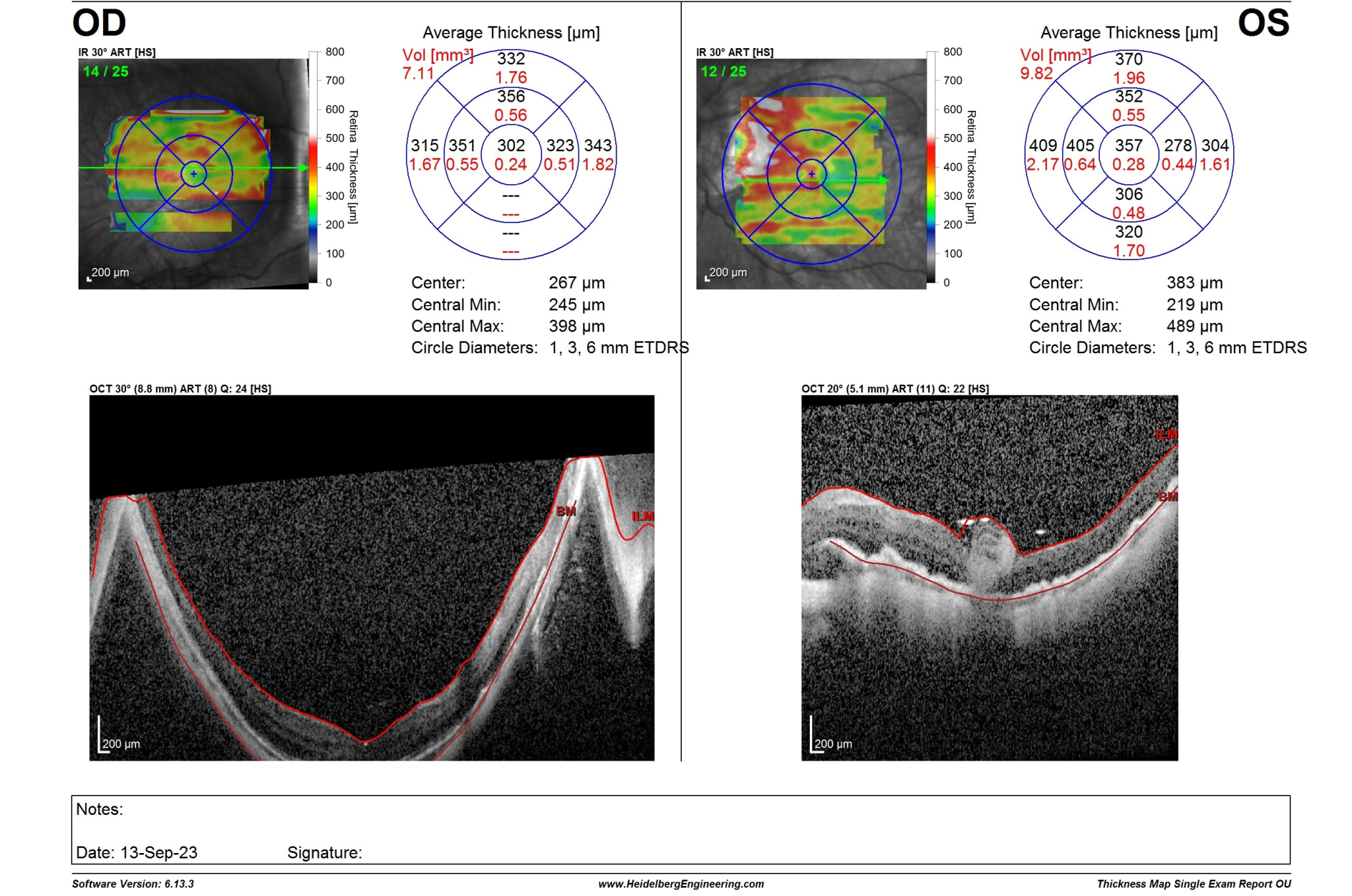 The First Autologous Retinal Transplant (ART) Performed at Hospital ...