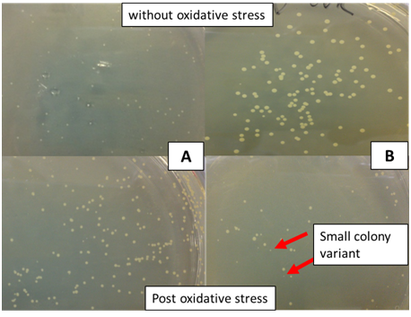 Persistent Infections of Staphylococcus Aureus: The Small Colony ...